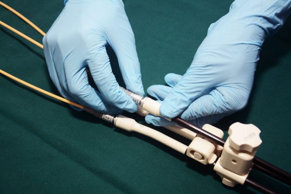 Brachytherapy - Cancer Treatment, External Radiotherapy